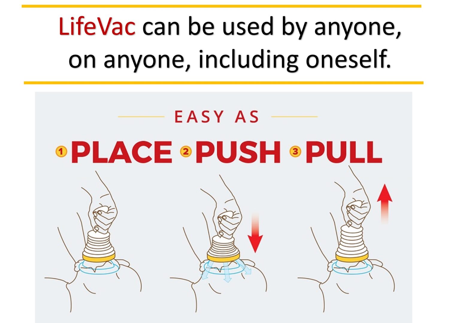 LifeVac Home & Travel Kit Bundle – LifeVac Canada – Choking First Aid ...